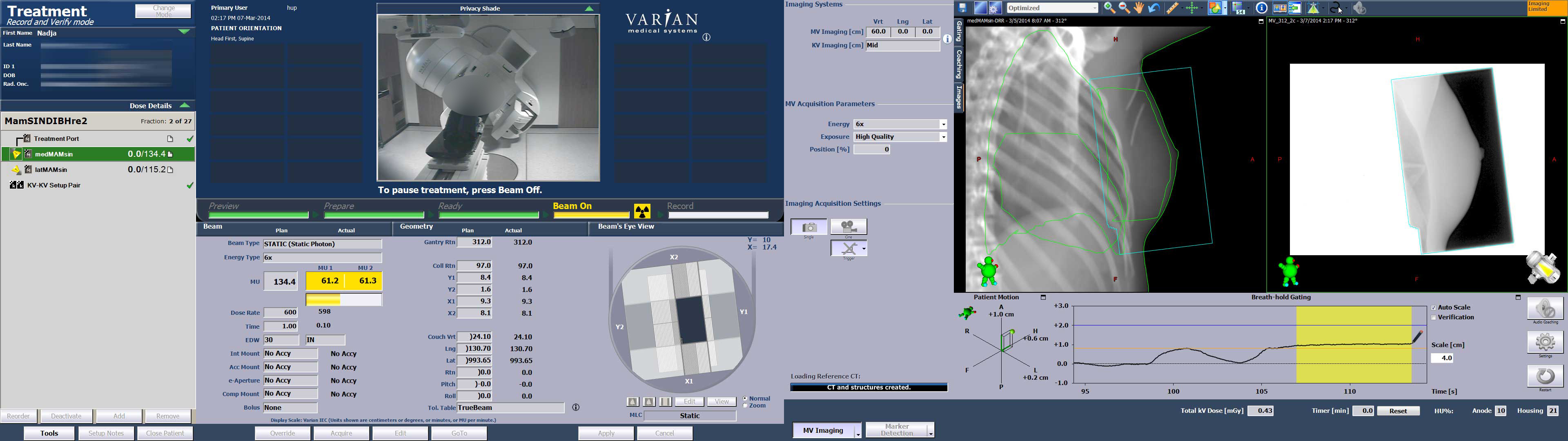 RGSC 1.0 - Varian's New Gating Solution for CT Scanners
