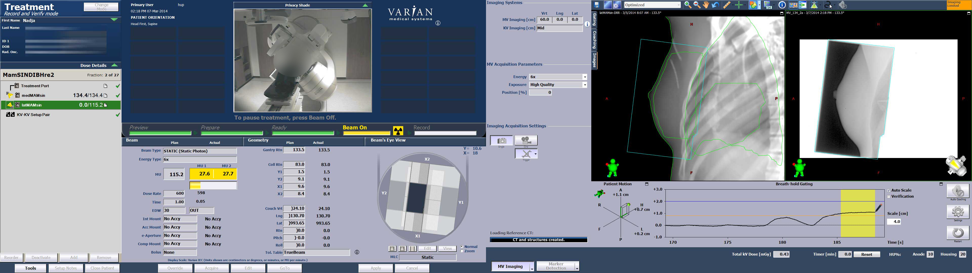 RGSC 1.0 - Varian's New Gating Solution for CT Scanners
