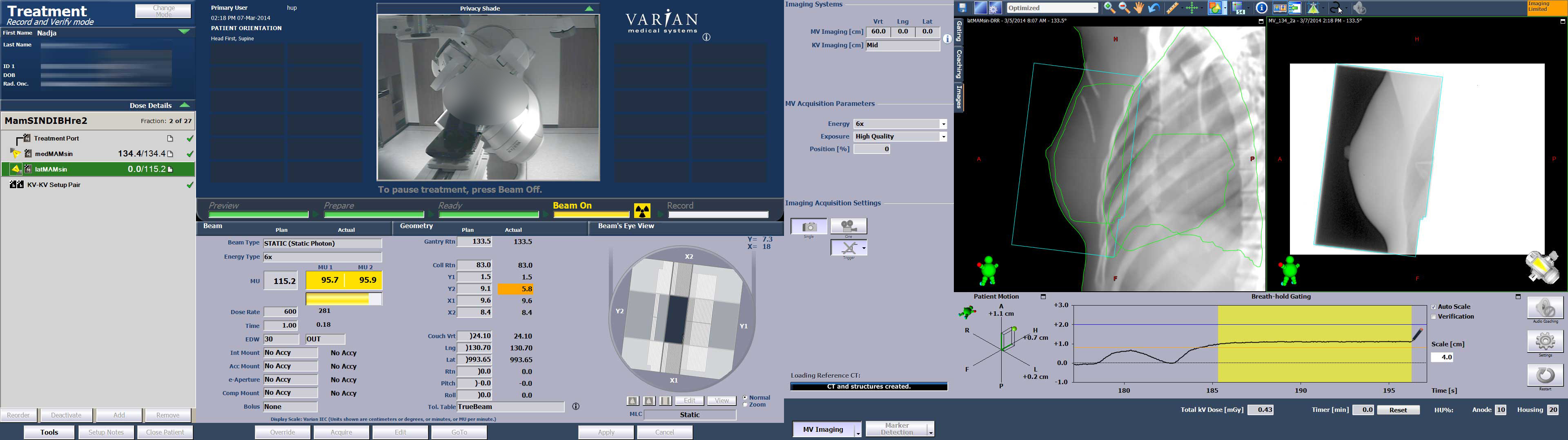 RGSC 1.0 - Varian's New Gating Solution for CT Scanners