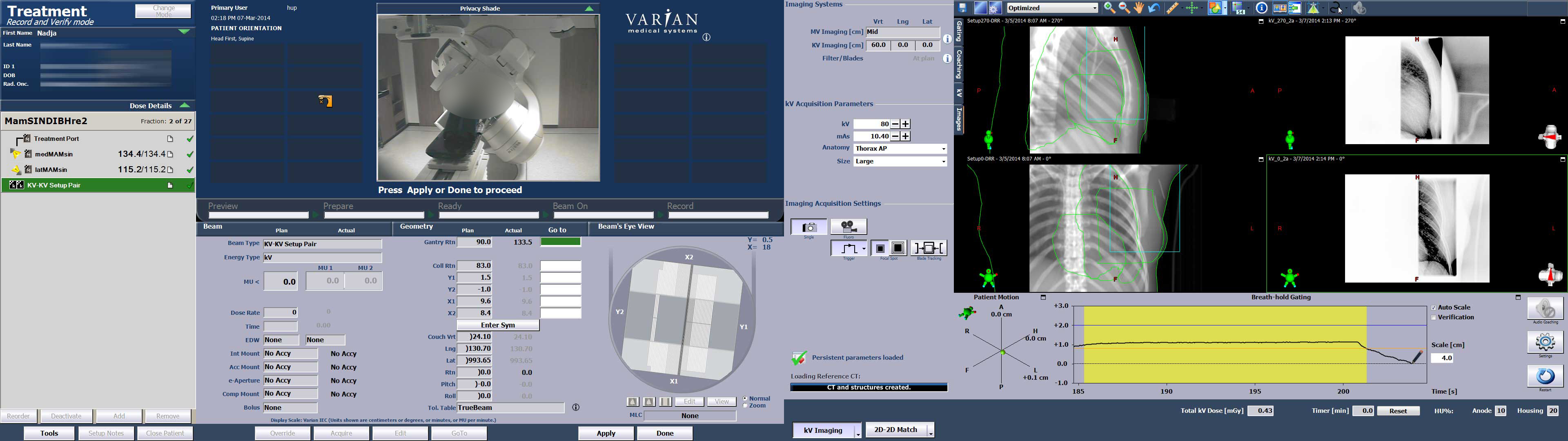 RGSC 1.0 - Varian's New Gating Solution for CT Scanners